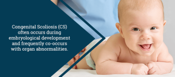 Symptoms of Scoliosis: Mild, Moderate, & Severe | Jason Lowenstein