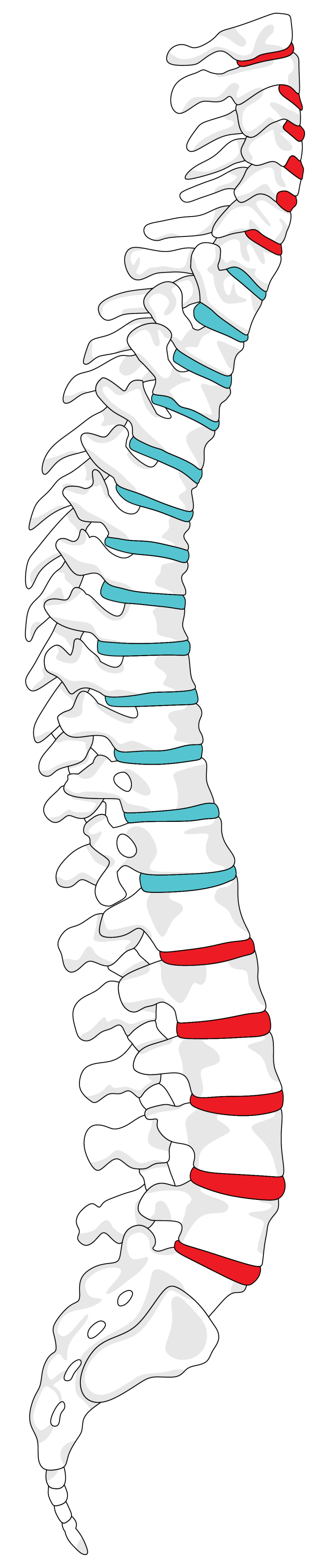 Lordosis | Dr. Jason Lowenstein